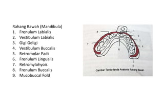 Cara mencetak dan pembuatan model rahang fitria rahmah (160110130077 ...
