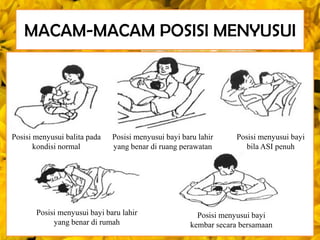 Cara Menyusui yang Benar | PPTX