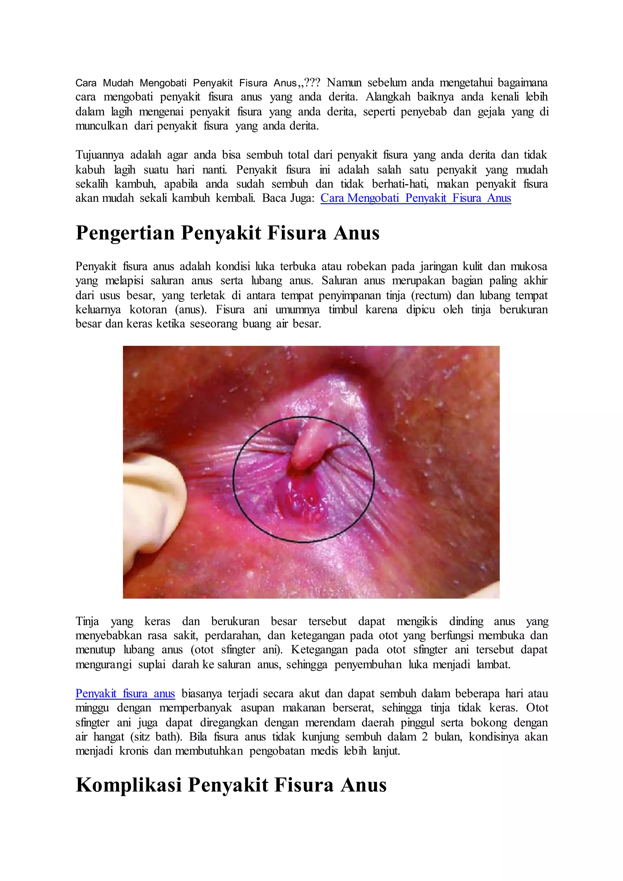 Cara mudah mengobati penyakit fisura anus | DOCX
