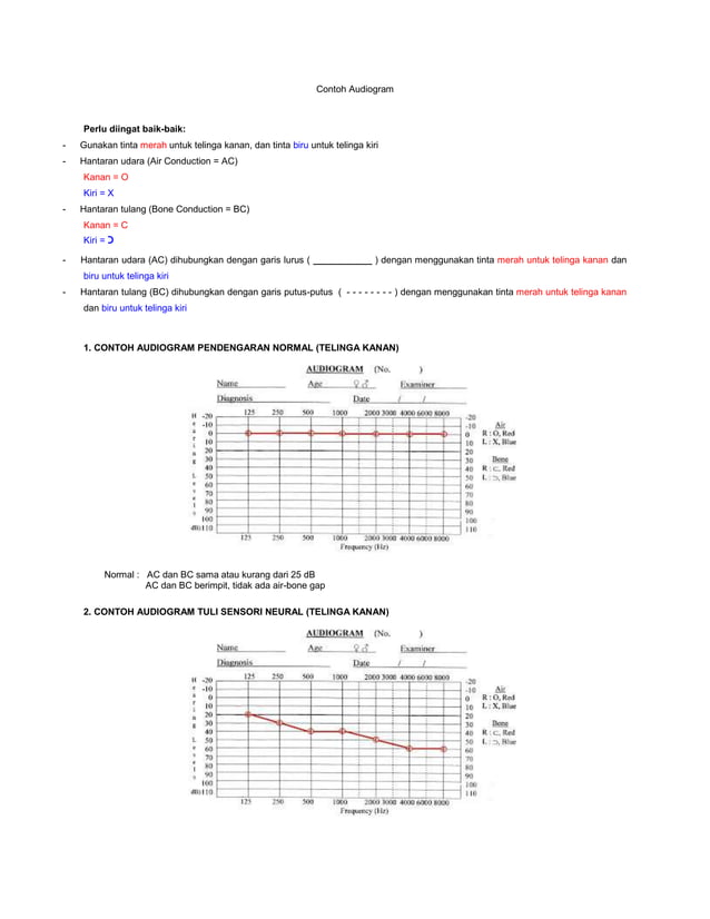 Cara pembacaan audiometri | DOCX
