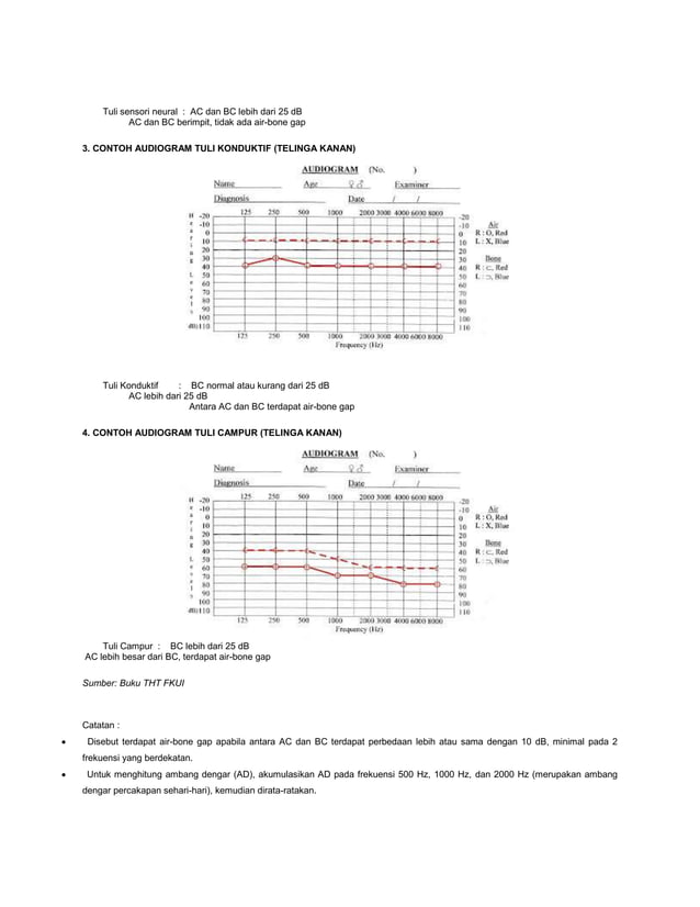 Cara pembacaan audiometri | DOCX