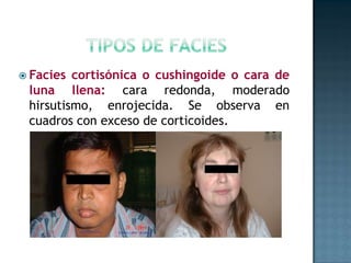 Semiologia Quirurgica Artiles (Cara) | PPTX
