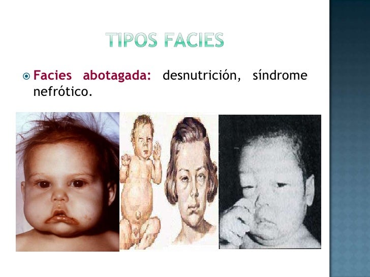 Semiologia Quirurgica Artiles (Cara)