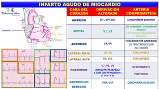 caras y artria en EKG.pptx