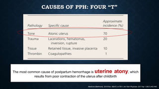 Carbetocin In PPH_ | PPTX