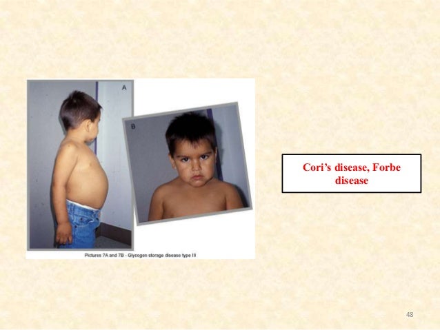 Carbohydrate metabolism