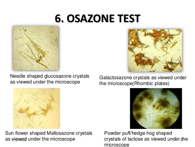 Carbohydrates analysis