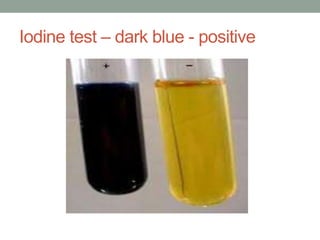 Tests for Carbohydrates | PPTX