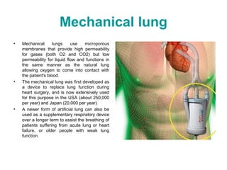 Carbon fiber and extra corporeal devices | PPT