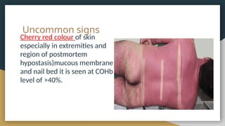Carbon monoxide poisoning Forensic medicine and toxicology | PPTX