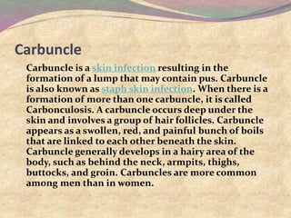 Carbuncle | PPT