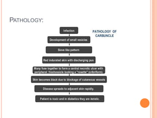 carbuncle-200701043053 (1).pdf