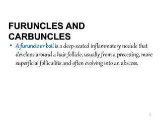 Carbuncle.pptx