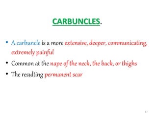 Carbuncle.pptx