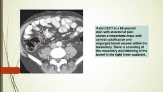 Lymphoma and Neuro endocrine tumors of intestine | PPTX