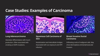 Carcinoma-Histopathology-A-Visual-Guide.pptx