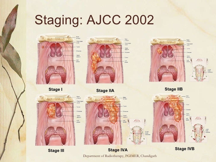 Nasopharynx Cancer Anatomy And Images