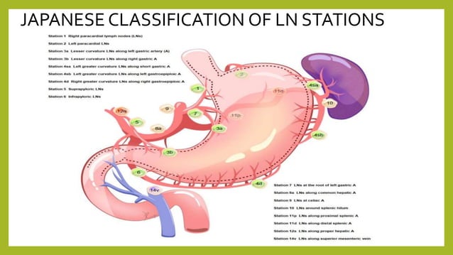 CARCINOMA STOMACH Etiology, clinical features.pptx