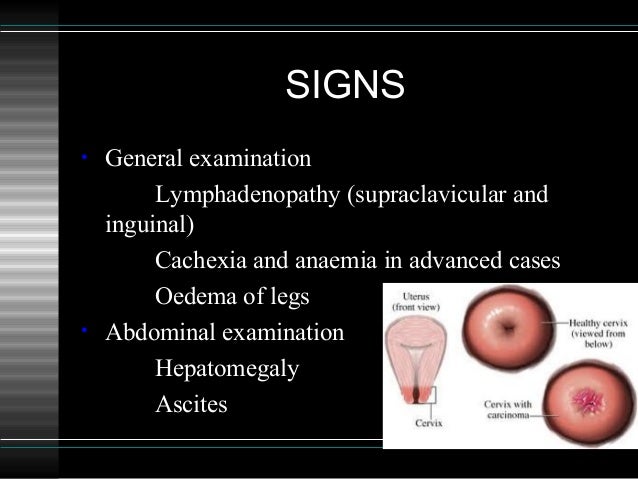 Friable Cervix During Pregnancy