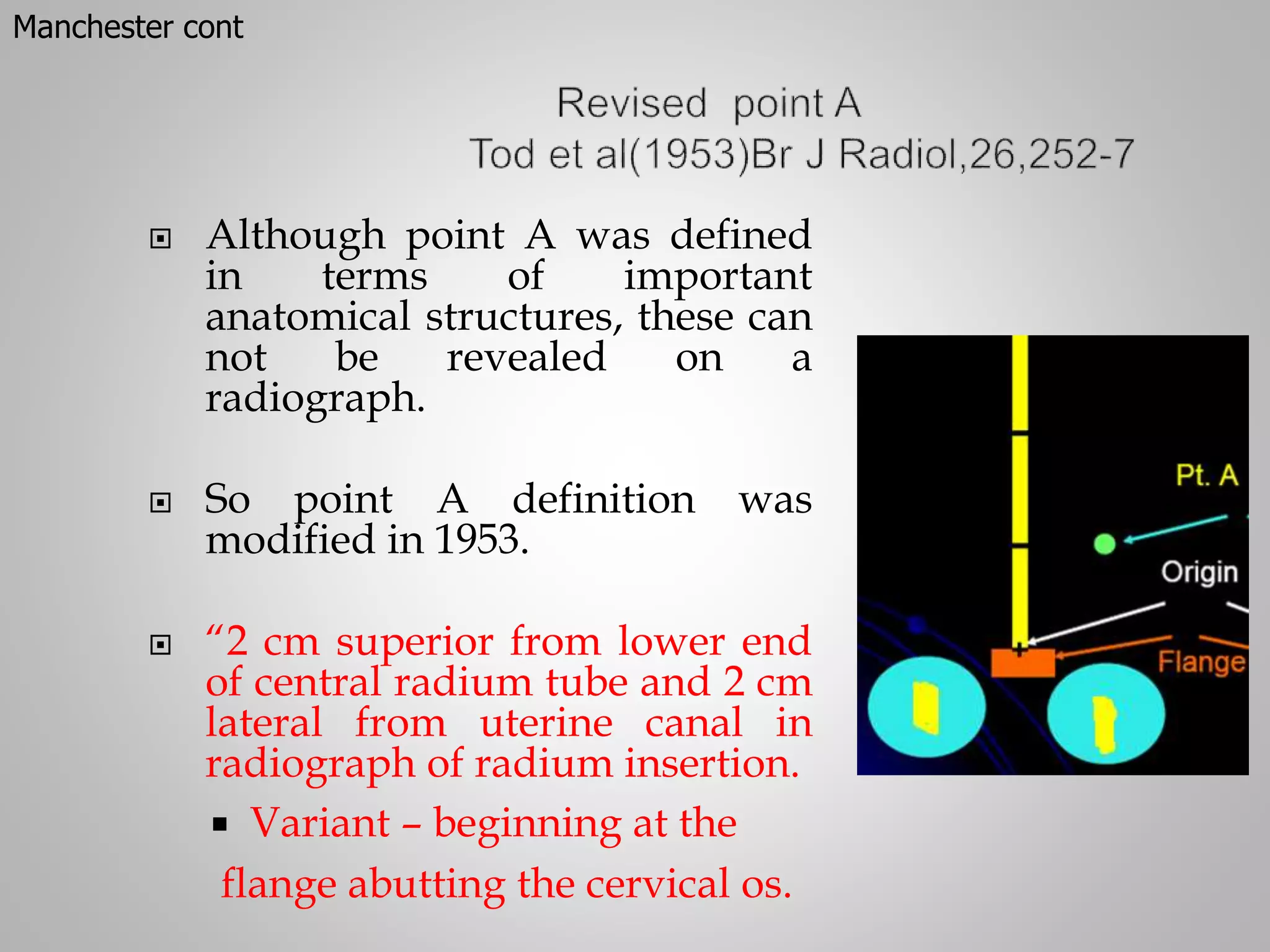 Carcinoma cervix brachytherapy- dr upasna | PPTX