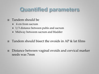 Carcinoma cervix brachytherapy- dr upasna | PPTX