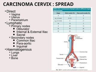 carcinoma of cervix and its presentations, treatment | PPTX