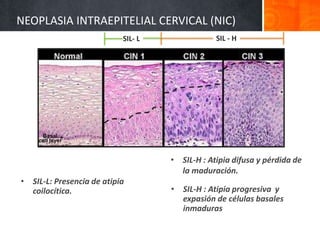 Cáncer de cervix | PPTX