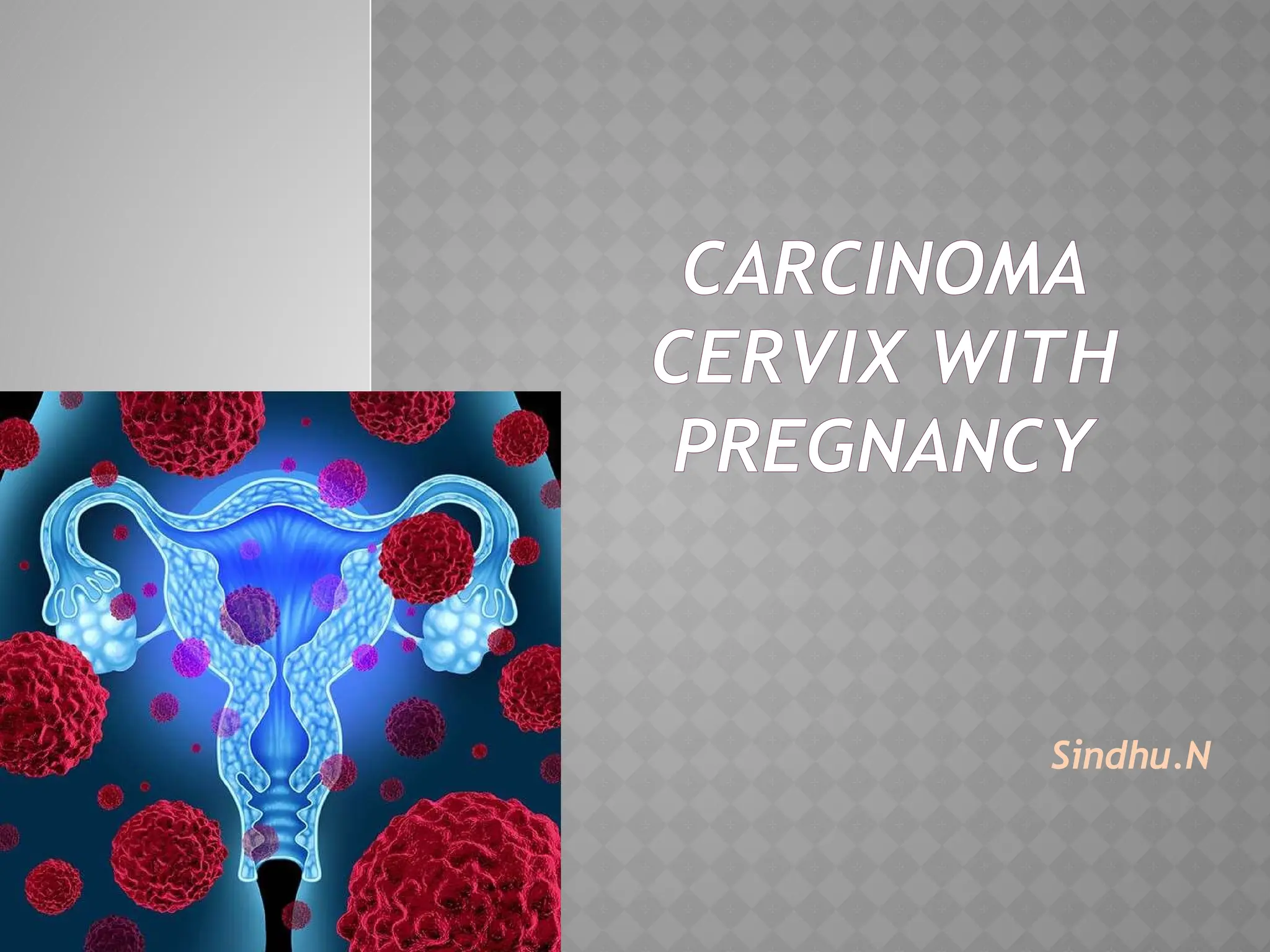 Carcinoma cervix with pregnancy, powerpoint | PPTX