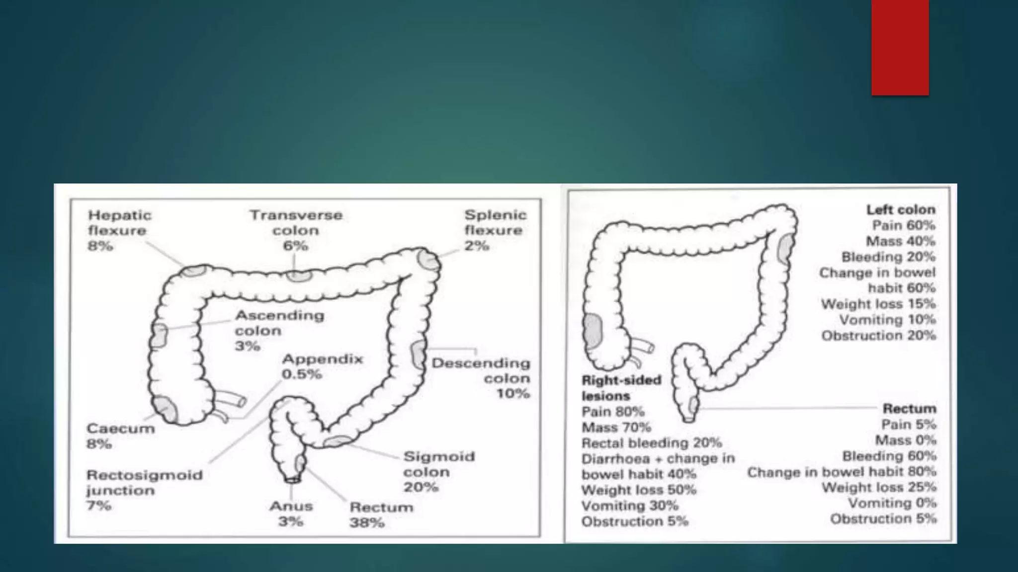 CARCINOMA COLON.pptx