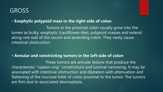 CARCINOMA COLON.pptx