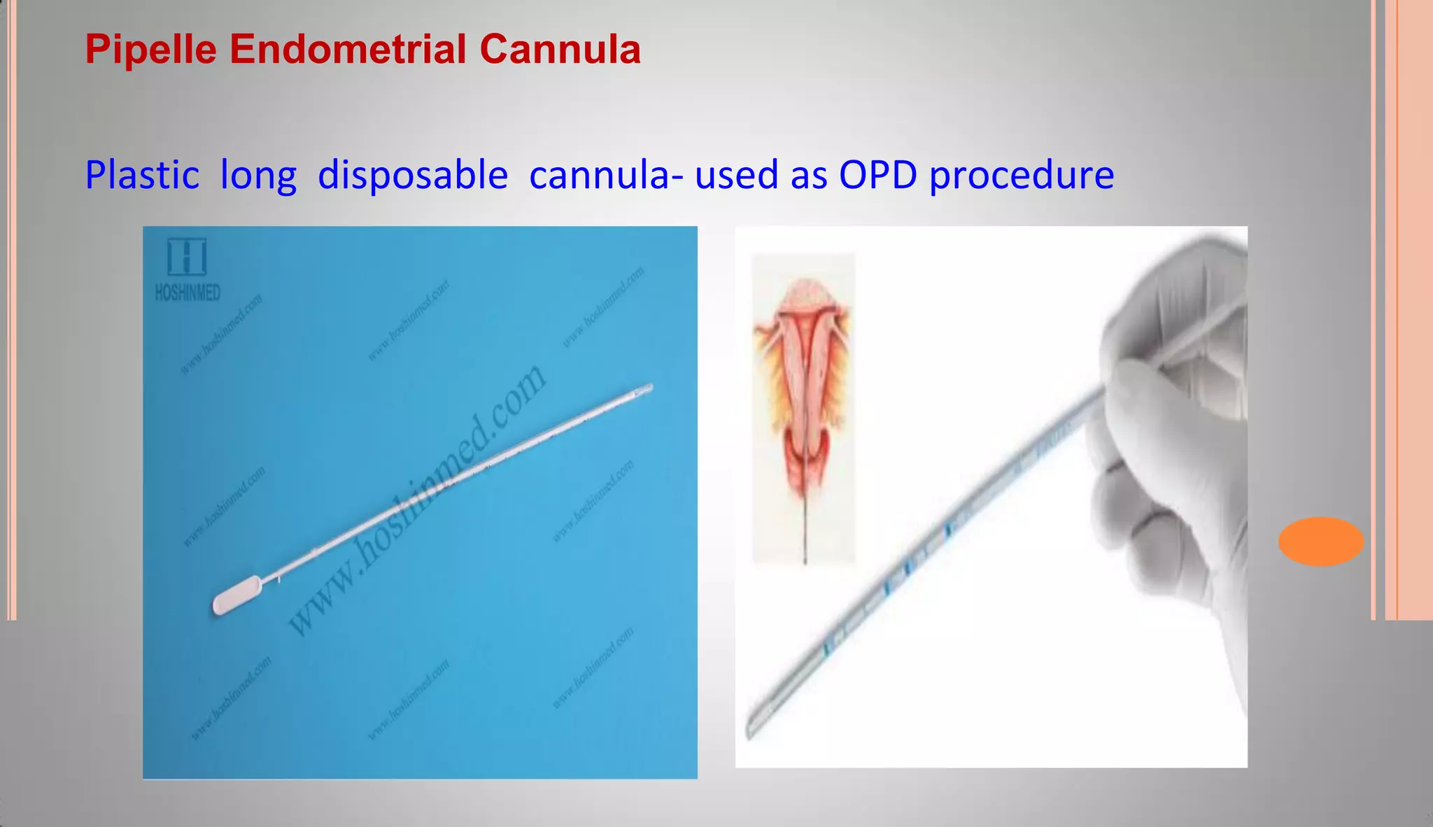 Carcinoma Endometrium DR H.K.Cheema Professor-OBG,PIMS Jalandhar | PDF