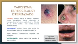 CARCINOMA EPIDERMOIDE Dermatología Clínica | PPTX