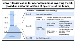 Carcinoma Esophagus & GE jn management.pptx