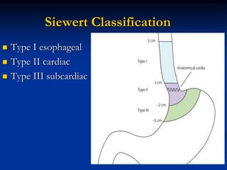 Carcinoma esophagus staging | PPT