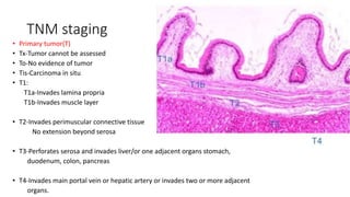 Carcinoma gallbladder. | PPT