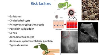 Carcinoma gallbladder. | PPT