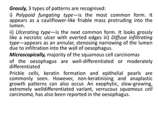 Carcinoma GI tract- Buccal, Esophagial, Gastric & intestinal.pptx