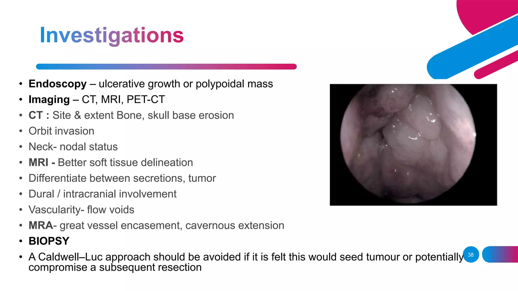 Carcinoma maxilla.pptx