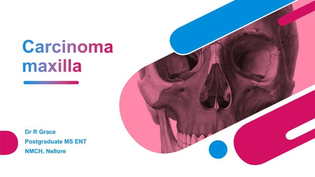 Carcinoma maxilla.pptx | Ear, Nose and Throat Conditions | Diseases and ...