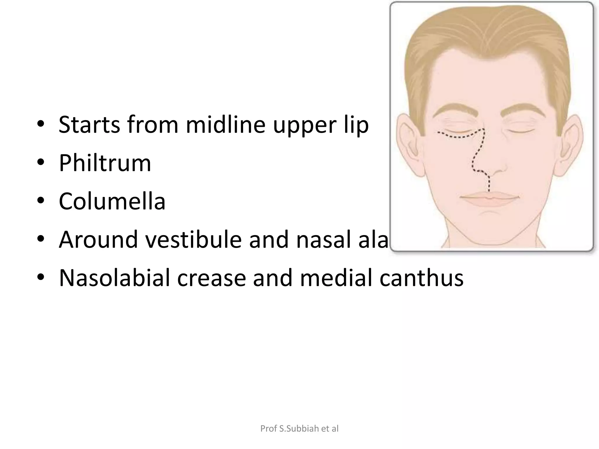 Carcinoma Maxillary sinus | PPTX