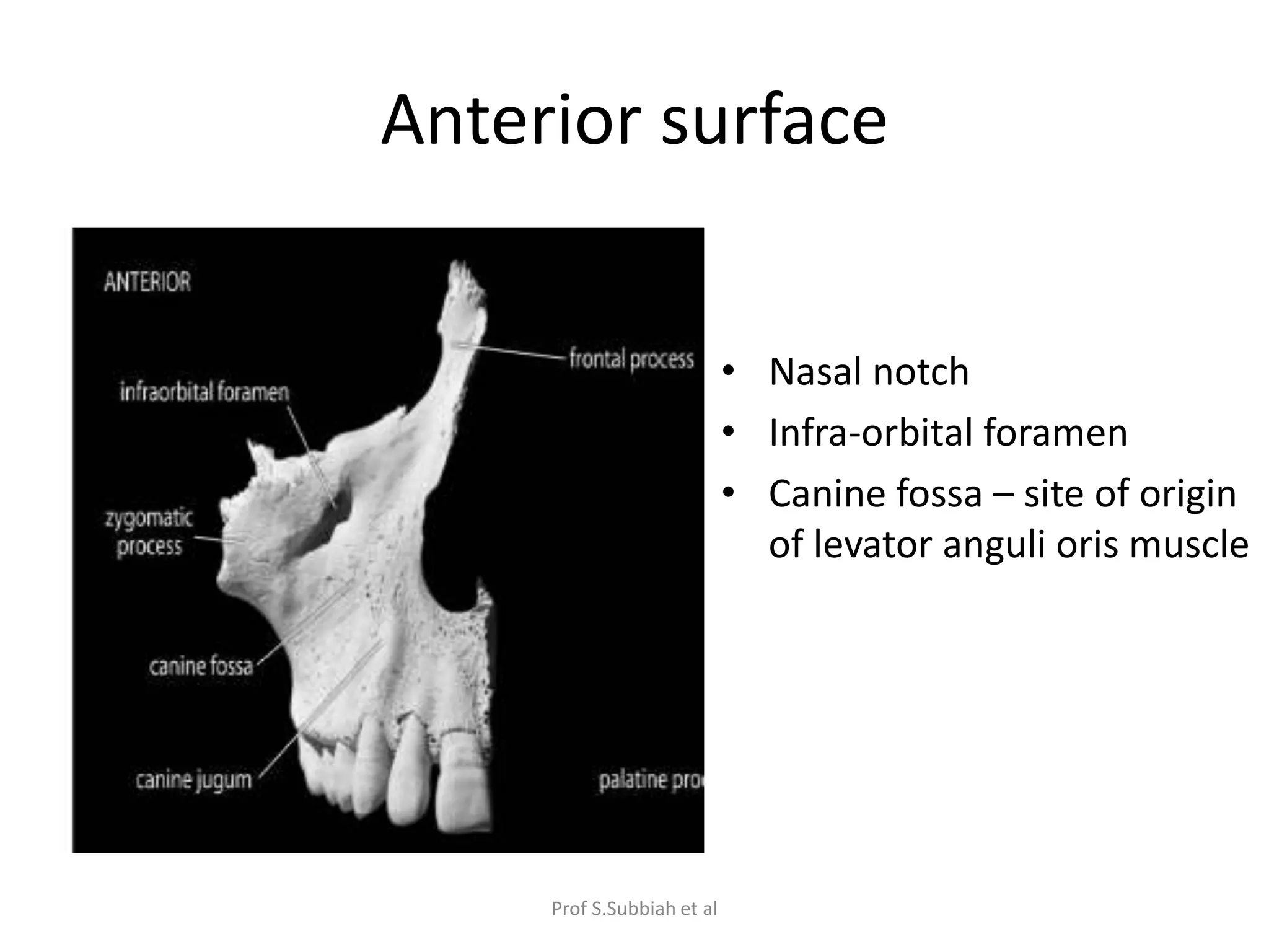 Carcinoma Maxillary sinus | PPTX