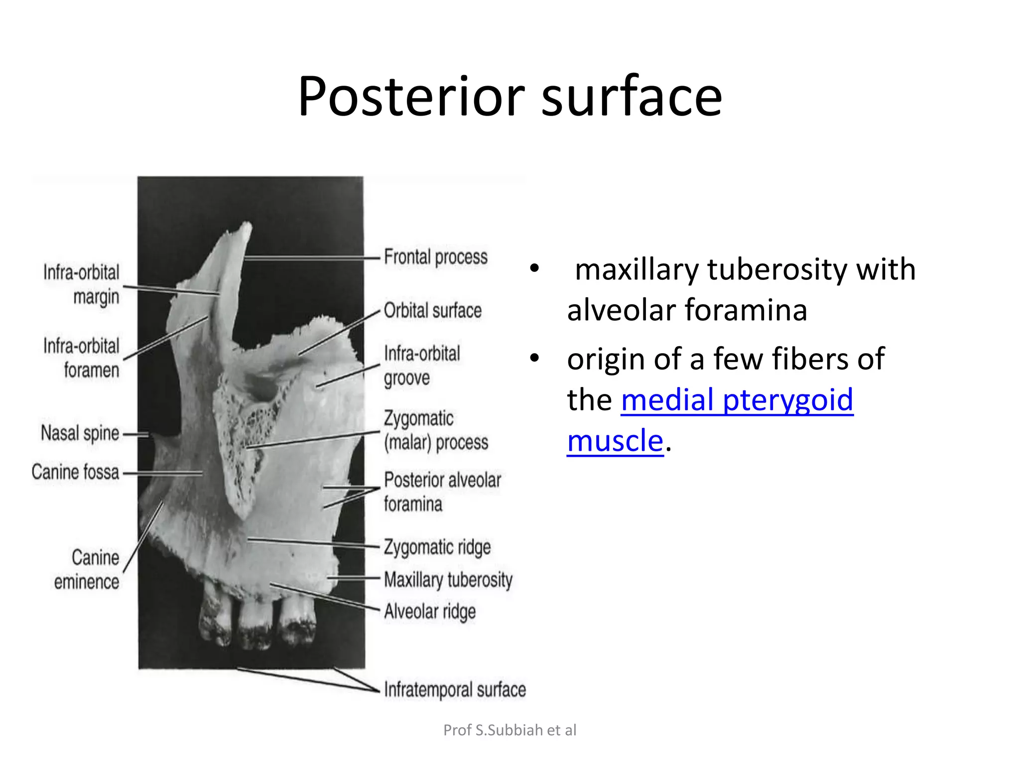 Carcinoma Maxillary sinus | PPTX