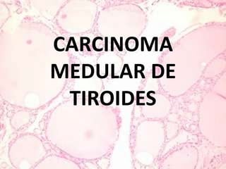 Carcinoma medular de tiroides | PPTX