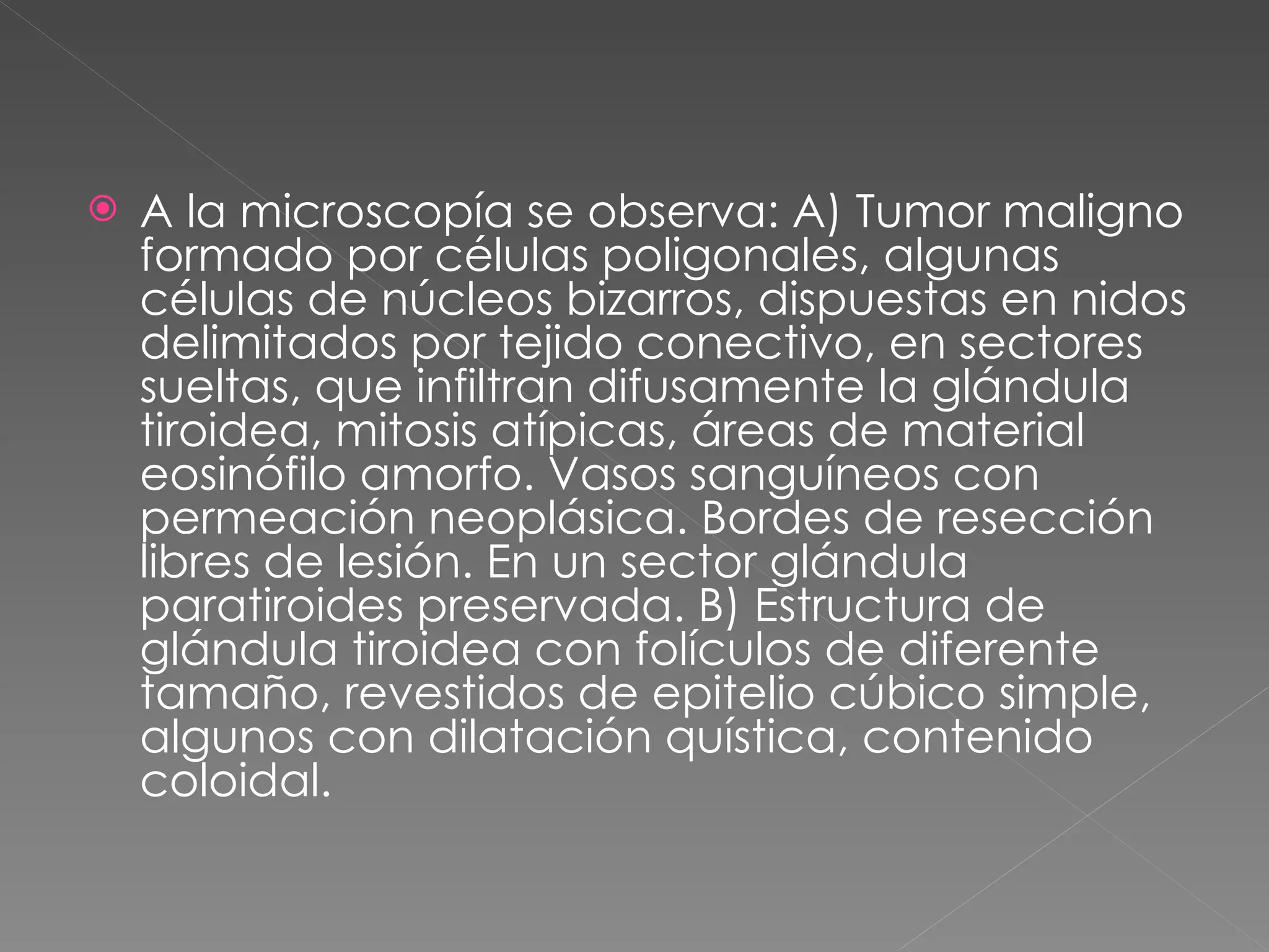 Carcinoma medular de tiroides sully rodriguez castro | PPT | Thyroid ...