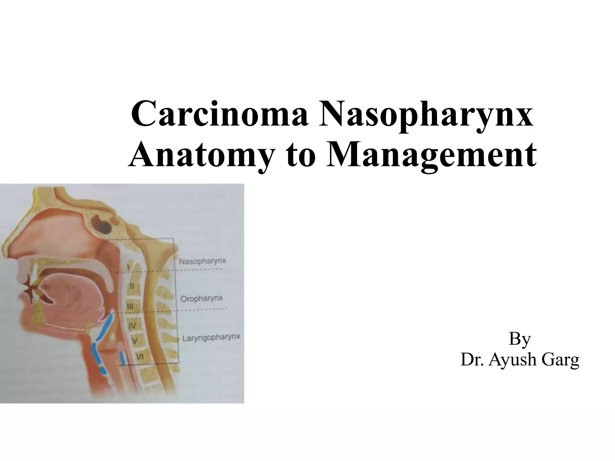 Carcinoma nasopharynx anatomy to management | PPT