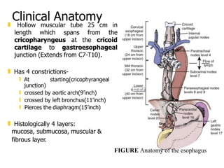 Carcinoma oesophagus | PPTX