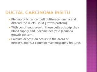 Carcinoma of breast | PPTX