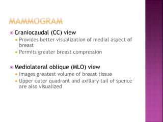 Carcinoma of breast | PPT