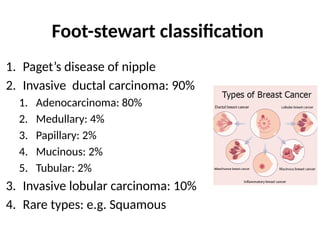 carcinoma of breast.pptx is best for surgery | PPT