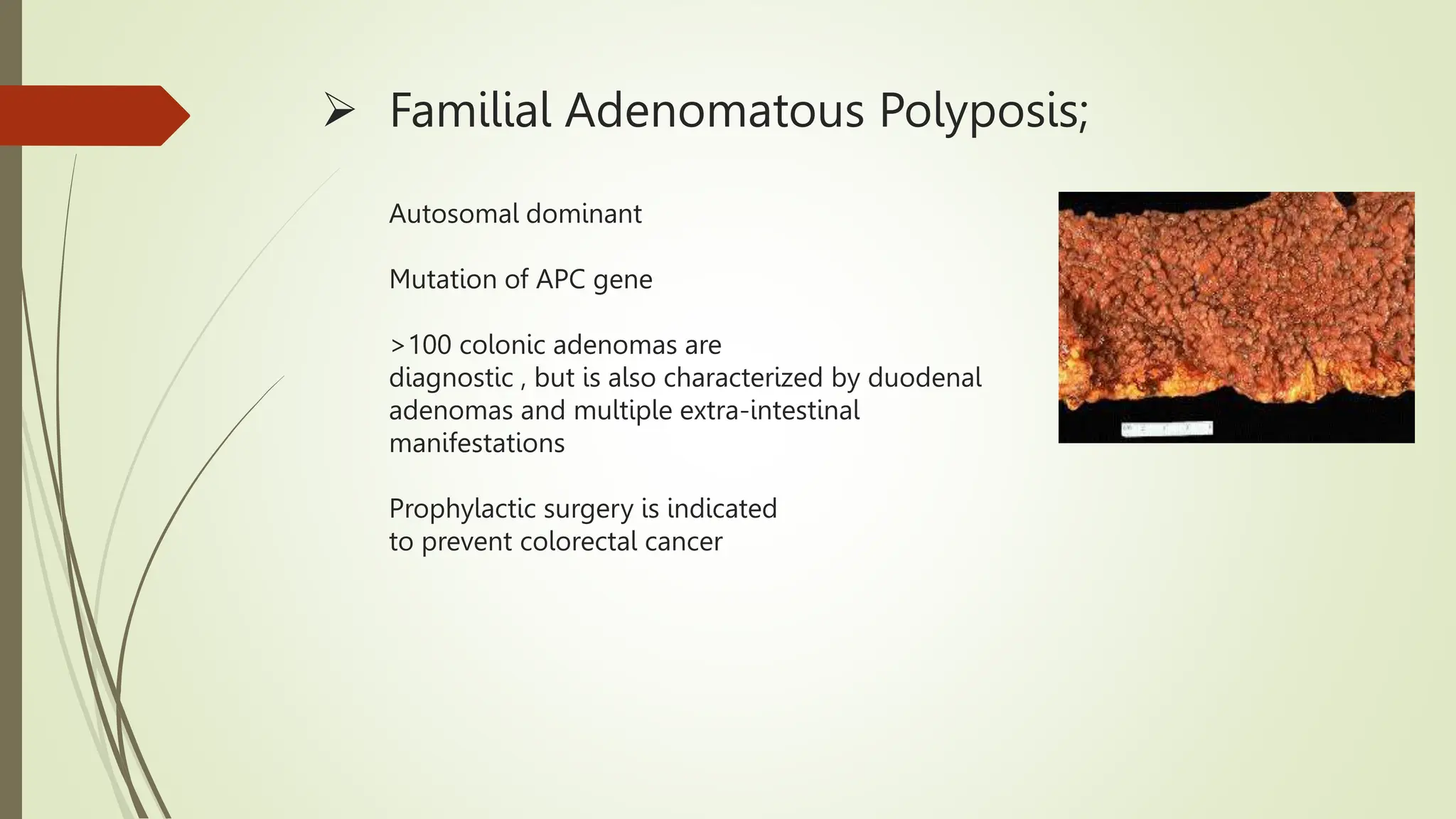 CARCINOMA OF CAECUM and treatment of lower GI cancers.pptx